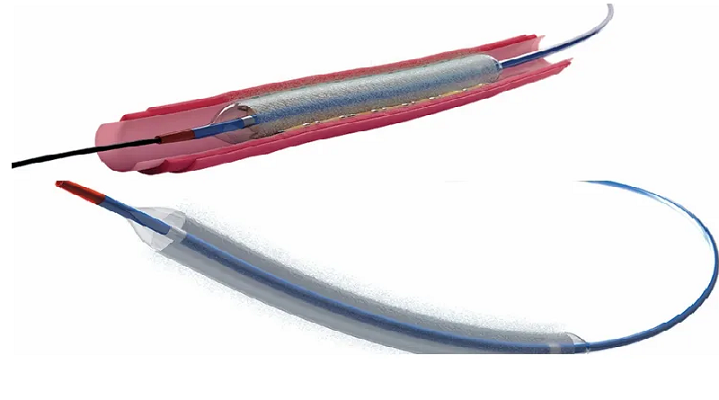 Boston Scientific’s Agent Drug-Coated Balloon Gets Approval